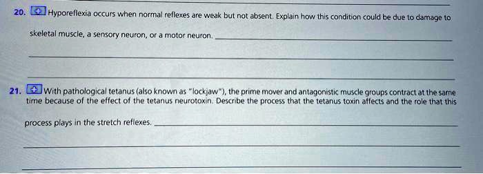 SOLVED: 20. Hyporeflexia occurs when normal reflexes are weak but not ...