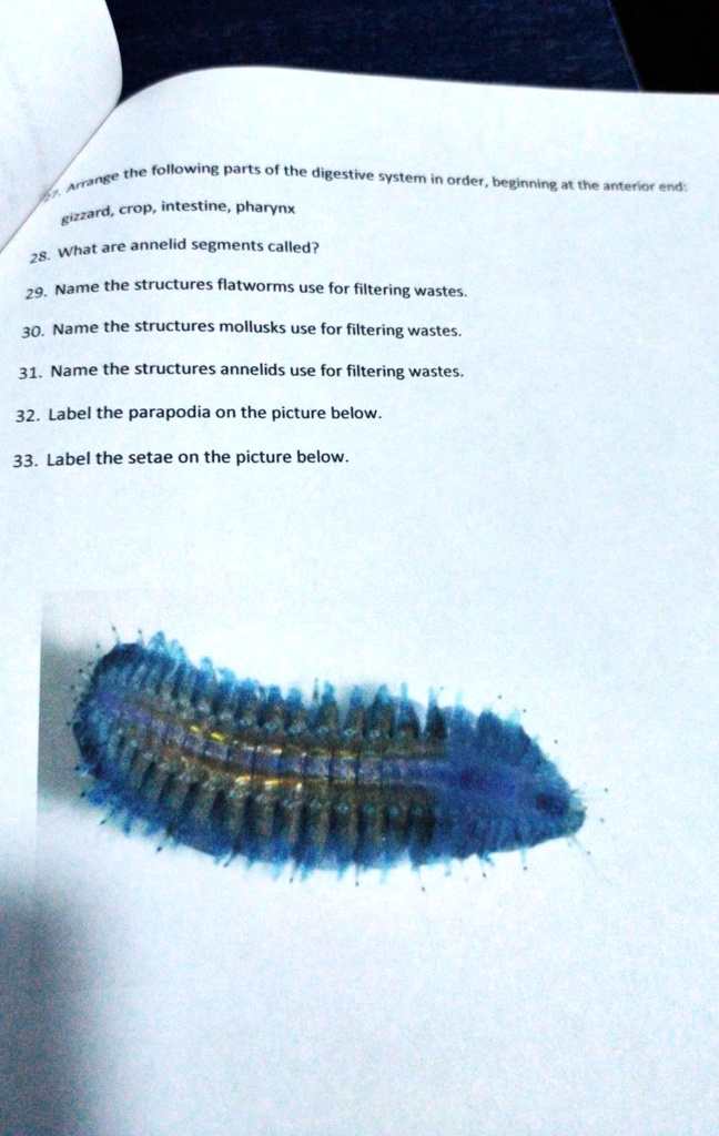 7. Arrange the following parts of the digestive system in order ...