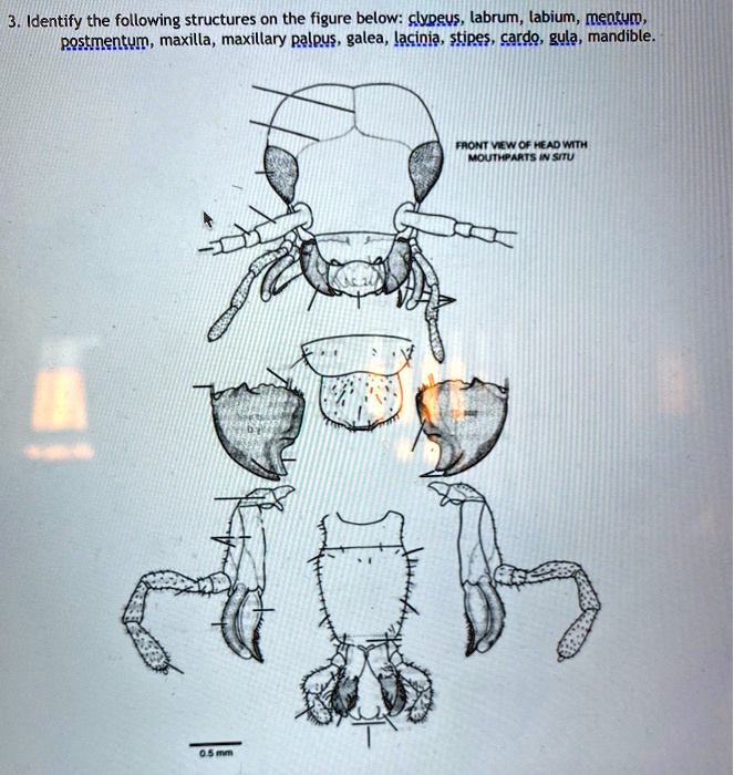 SOLVED: Identify the following structures on the figure below: clypeus ...