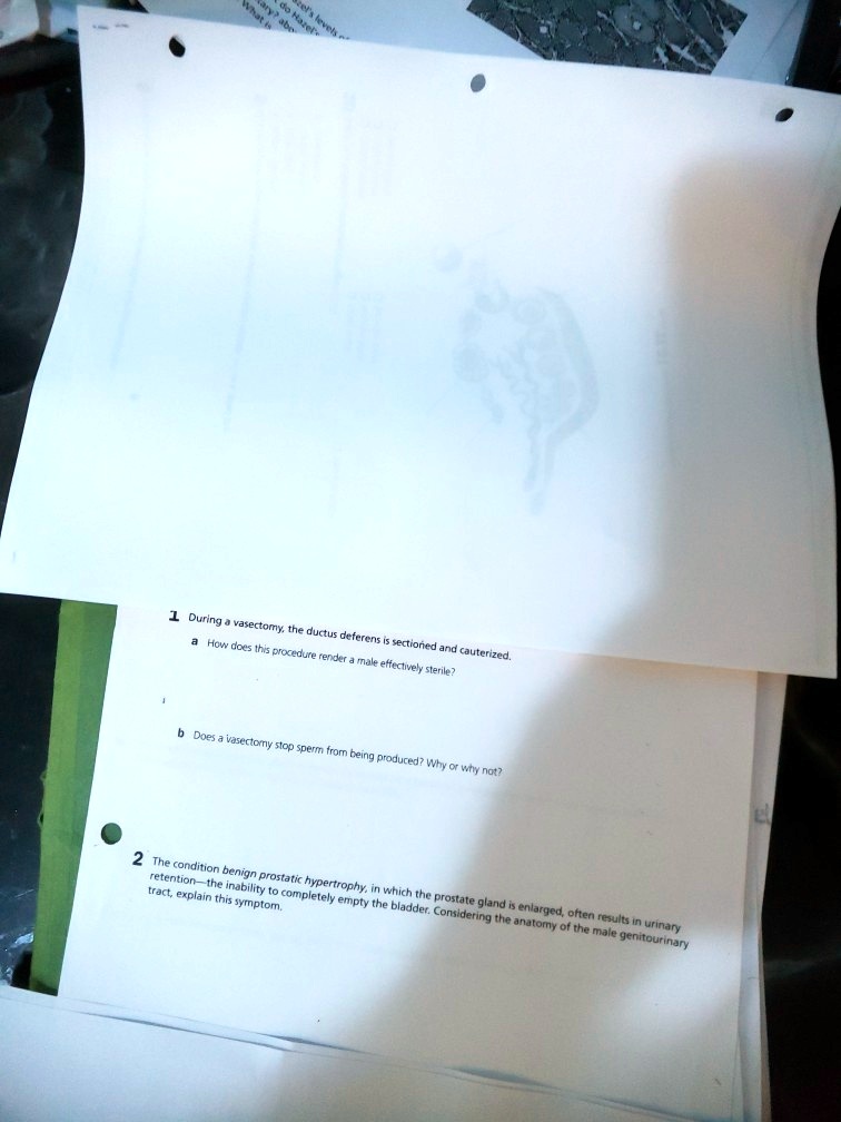 during a vasectomy the ductus deferens is sectioned and cauterized a ...