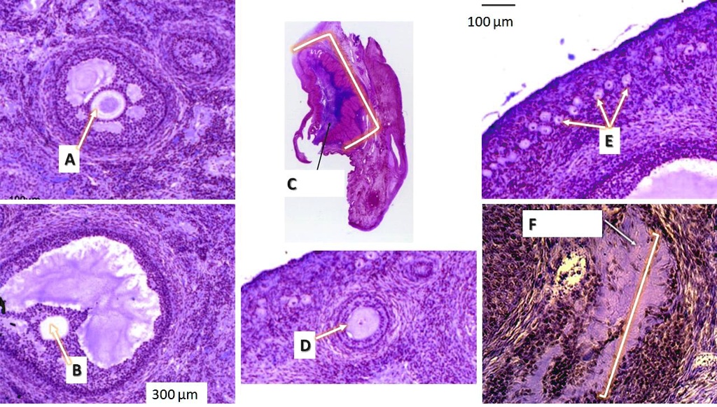 Corpus Albicans Histology CORPUS_LUTEUM_40X_label.jpg 900×673 pixels ...