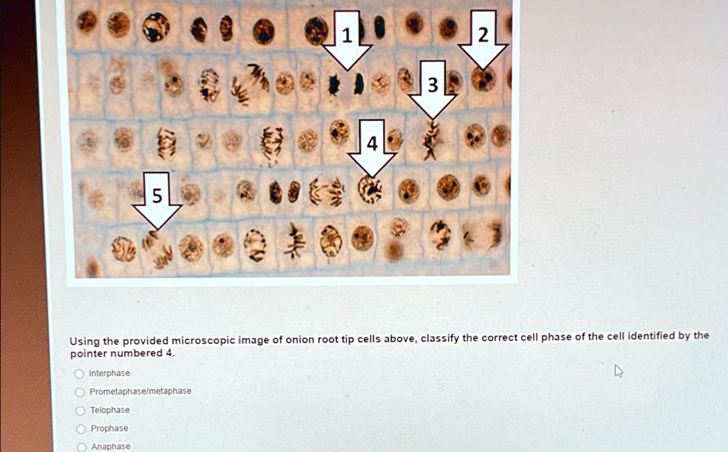 Using the provided microscopic image of onion root tip cells above ...