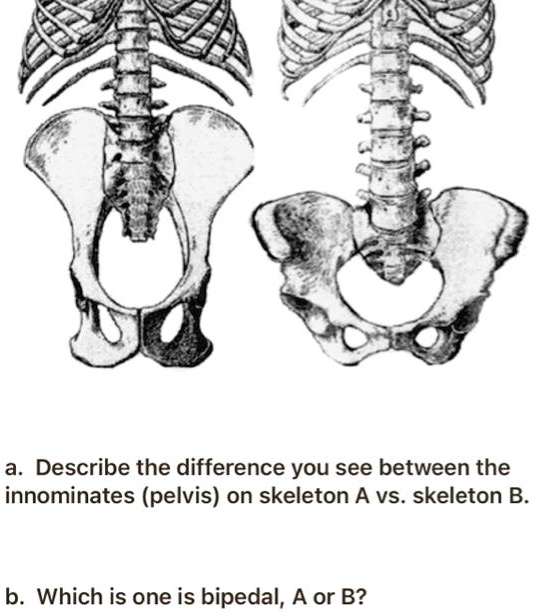 SOLVED: a. Describe the difference you see between the innominates ...