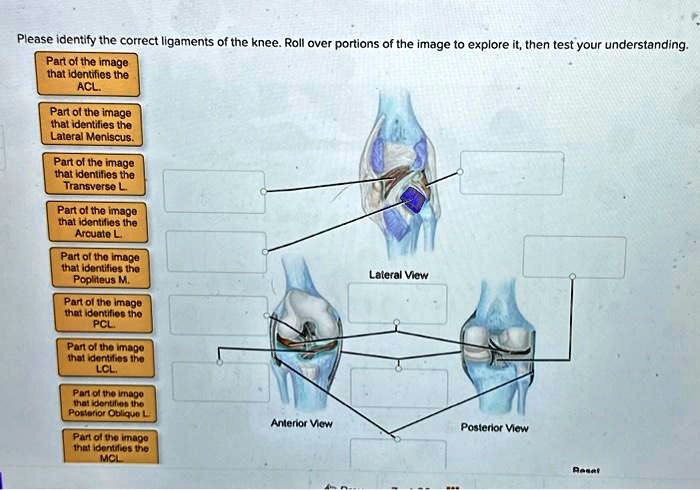 Please identify the correct ligaments of the knee. Roll over portions ...
