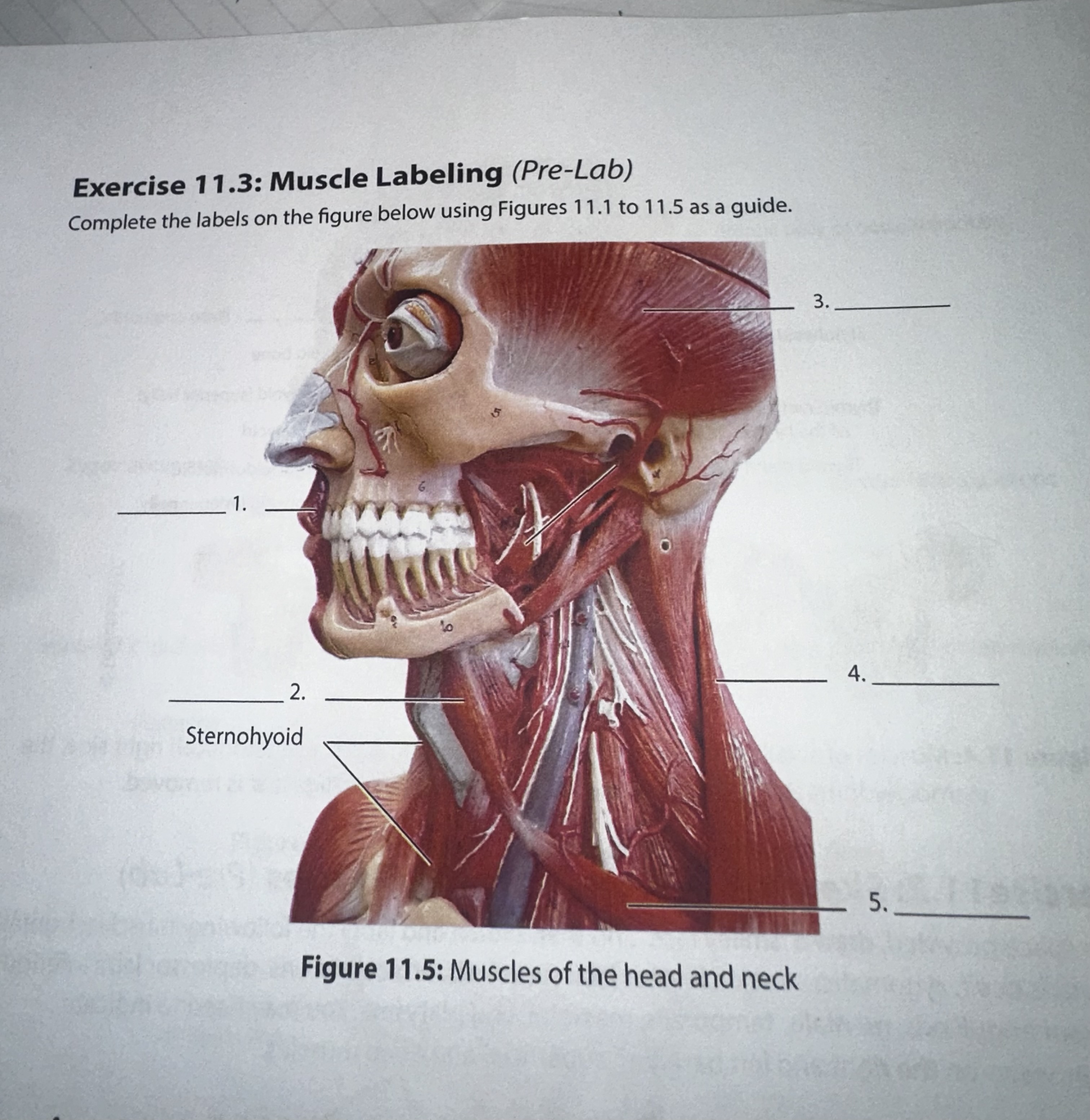 exercise 113 muscle labeling pre lab complete the labels on the figure ...