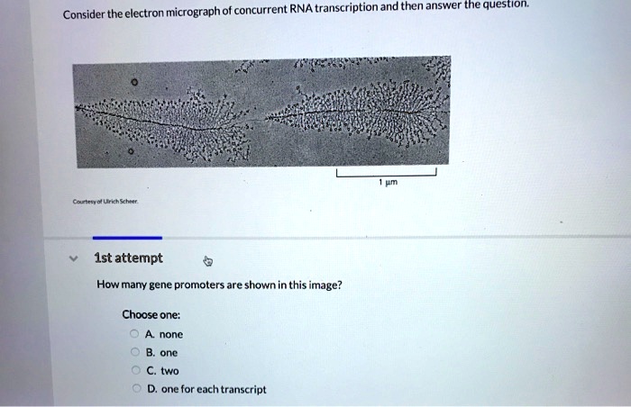Consider the electron micrograph of concurrent RNA transcription and then answer the question ...