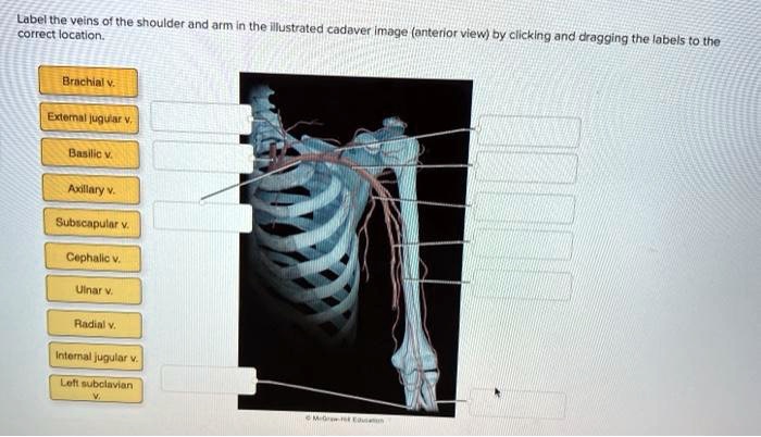 Label the veins of the shoulder and arm in the illustrated cadaver ...