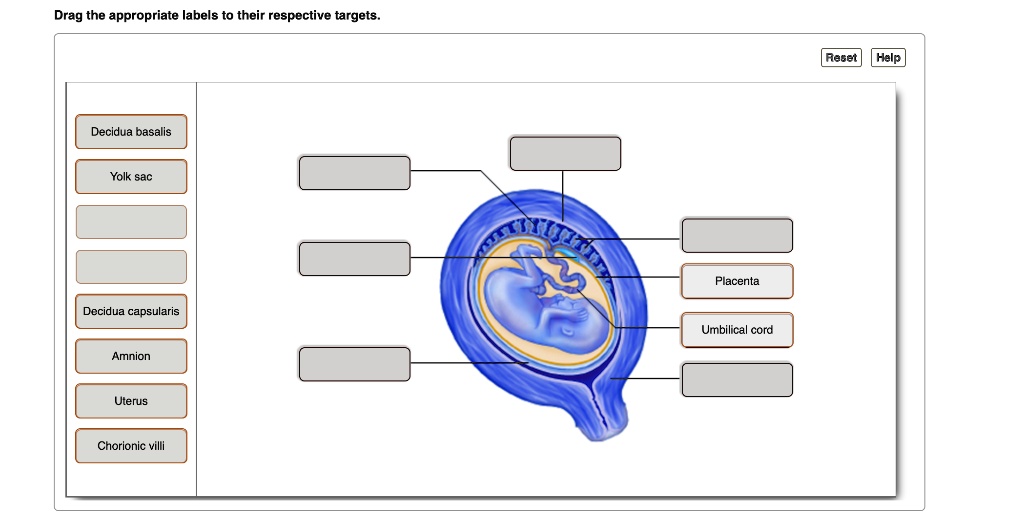 SOLVED: Decidua basalis Yolk sac Placenta Decidua capsularis Umbilical ...