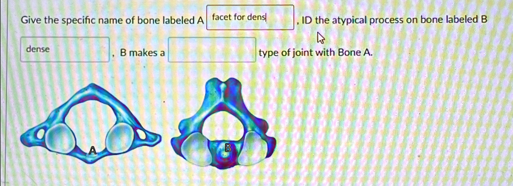 Give the specific name of bone labeled A , ID the atypical process on ...