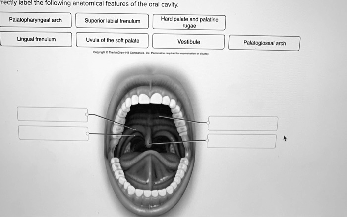 rectly label the following anatomical features of the oral cavity ...