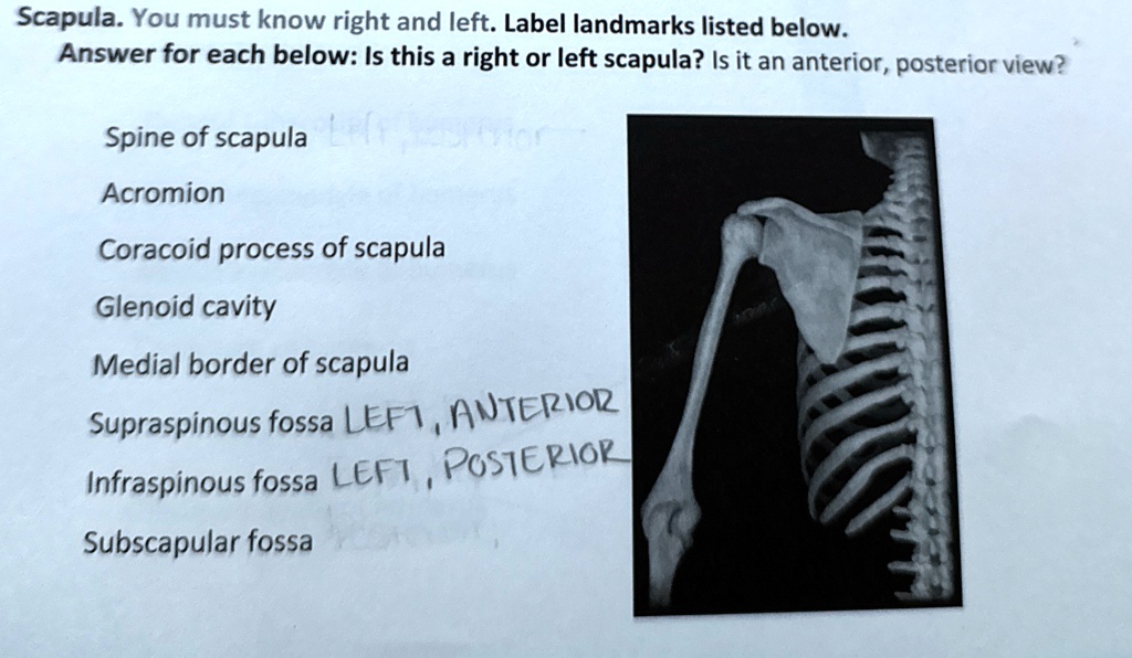 scapula you must know right and left label landmarks listed below ...