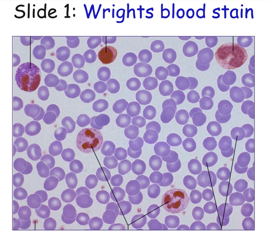 SOLVED: Slide 1: Wrights blood stain