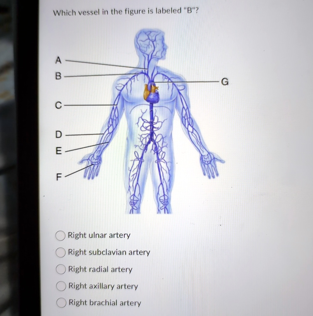 which vessel in the figure is labeled b a b c d e f right ulnar artery ...