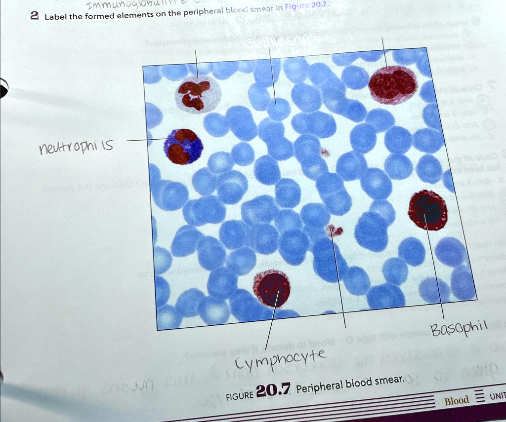 immunoglobu 2 label the formed elements on the peripheral blood smear ...
