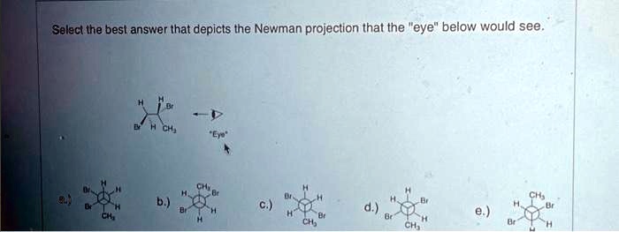 Select the best answer that depicts the Newman projection that the "eye ...