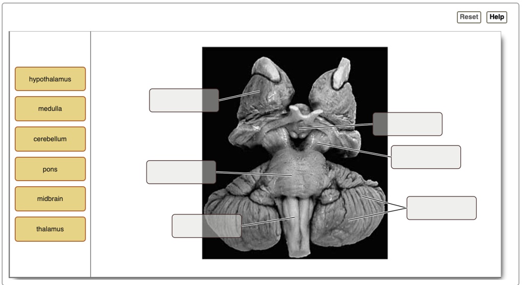 SOLVED: Label the structures that can be seen on this view of the ...