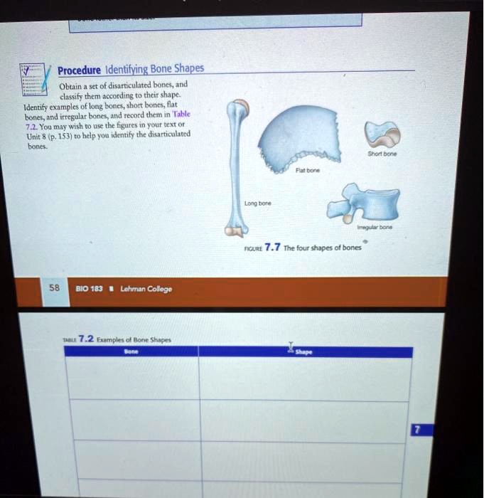 SOLVED: Procedure: Identifying Bone Shapes Observe a set of ...