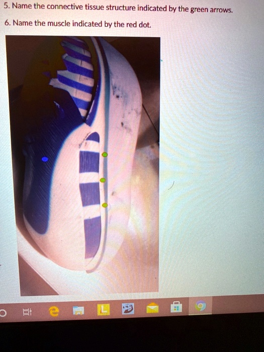 5. Name the connective tissue structure indicated by the green arrows ...