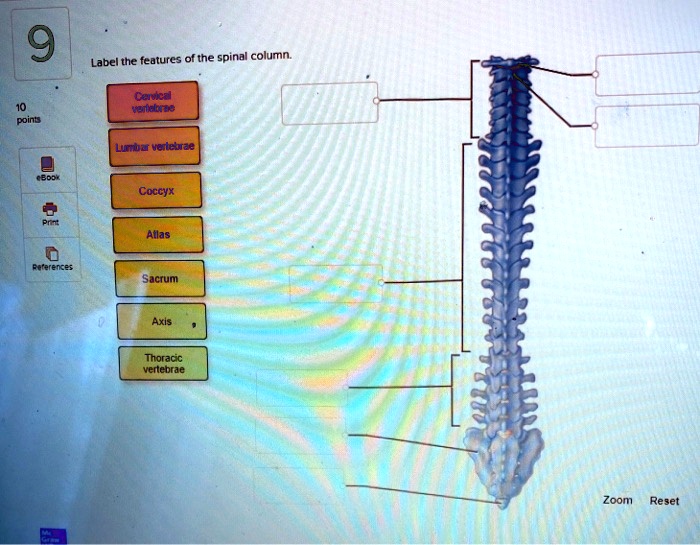 9 label the features of the spinal column cervical vertebrae 10 points ...