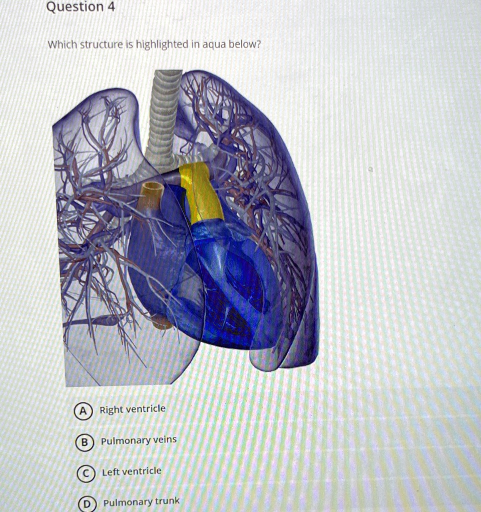 SOLVED: 'Question 4 Which structure is highlighted in aqua below? Right ventricle Pulmonary ...