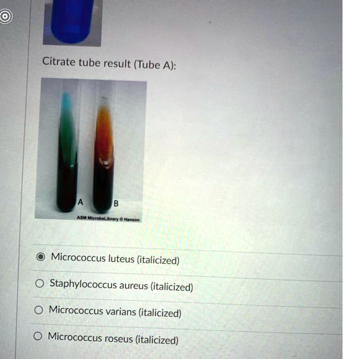 SOLVED:Citrate tube result (Tube A): Micrococcus luteus (italicized ...
