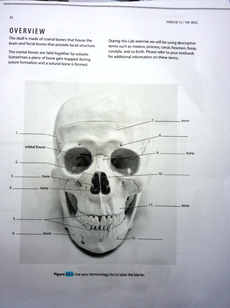 82 EXERCISE 13 THE SKULL OVERVIEW The skull is made of cranial bones ...