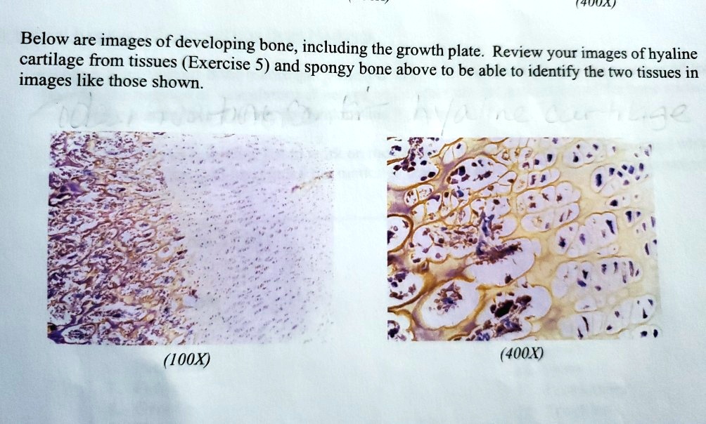 SOLVED: please assist in identifying these 2 tissues. 400X Below are ...