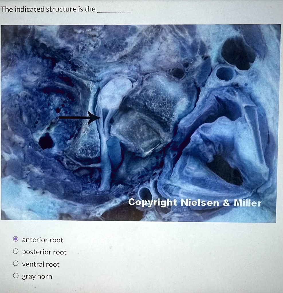 The indicated structure is the anterior root posterior root ventral ...