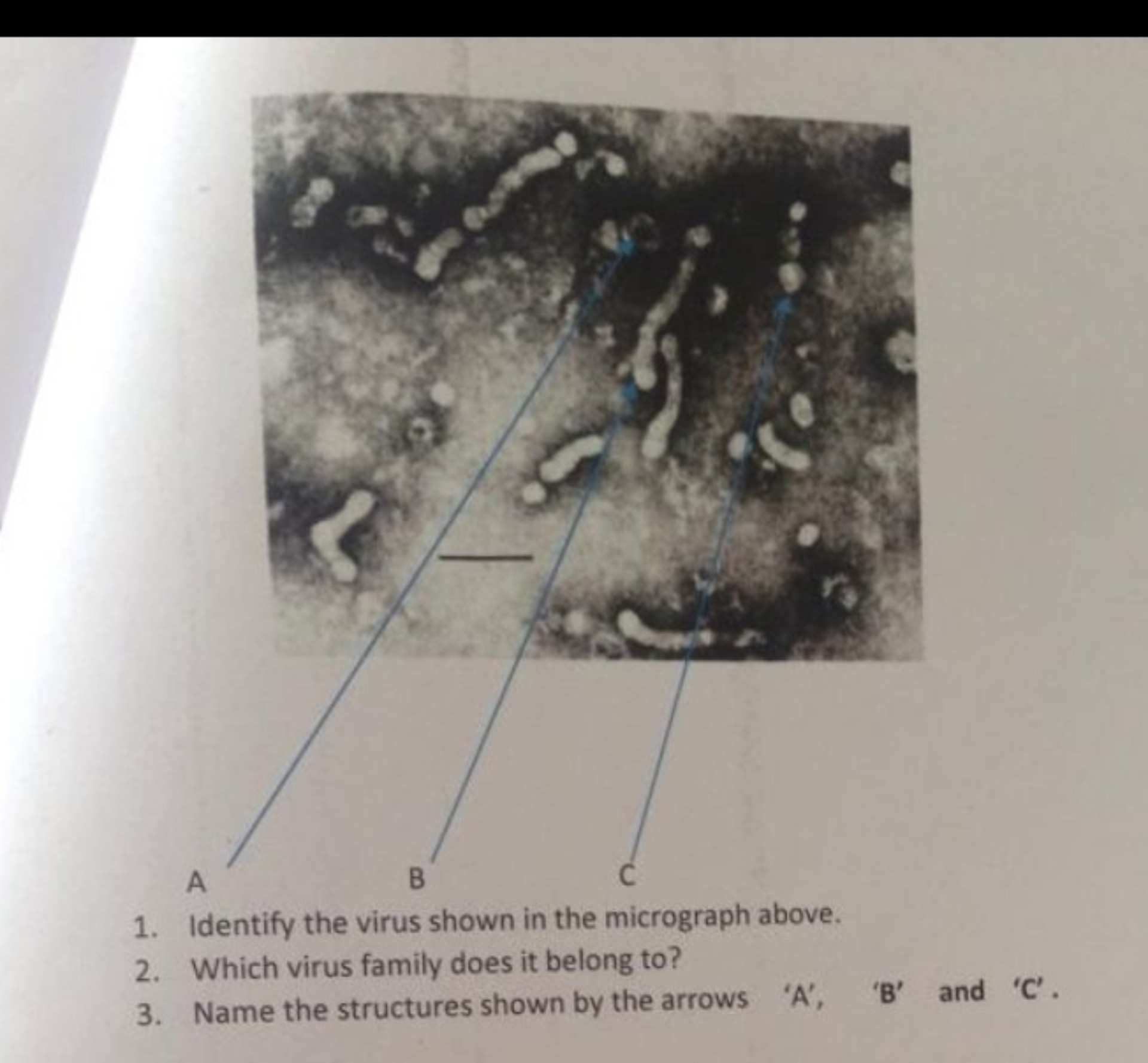 a 1 identify the virus shown in the micrograph above 2 which virus ...