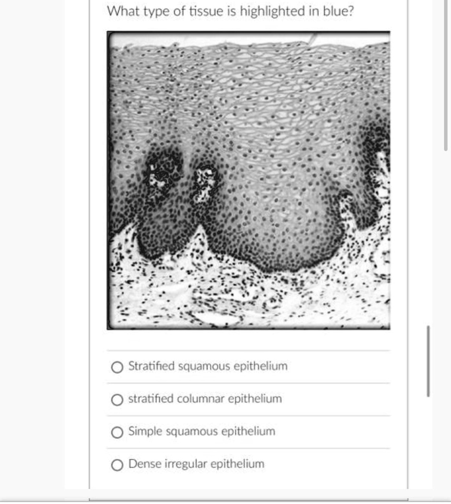 What type of tissue is highlighted in blue? Stratified...