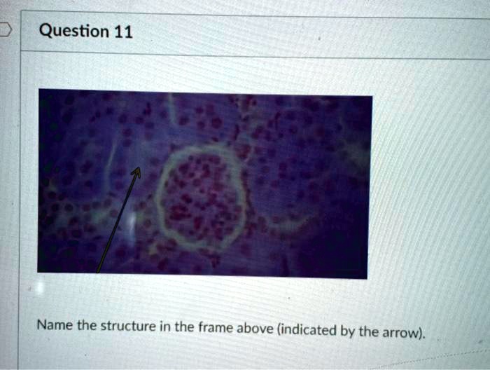 question 11 name the structure in the frame above indicated by the arrow 98778
