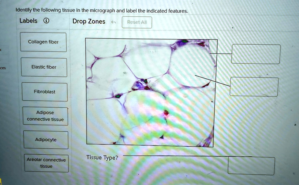 Identify the following tissue in the micrograph and label the indicated ...