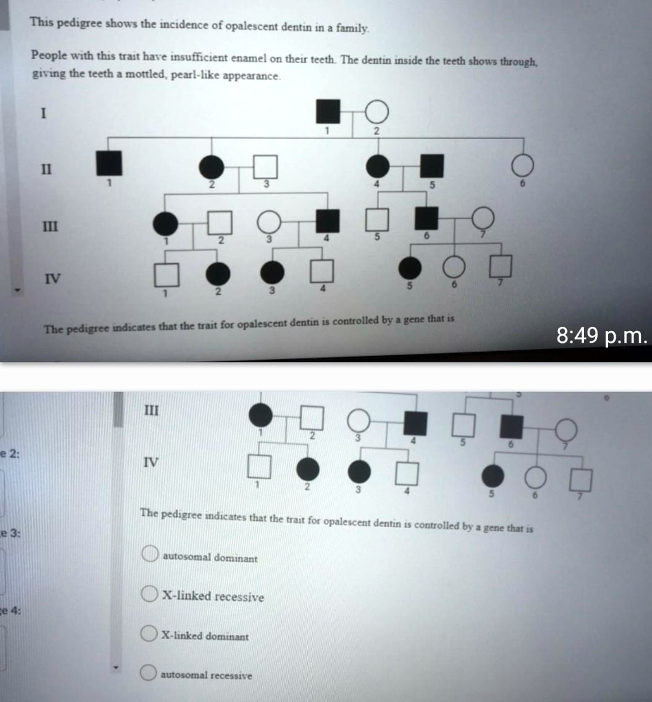 SOLVED: This pedigree shows the incidence of opalescent dentin in a ...