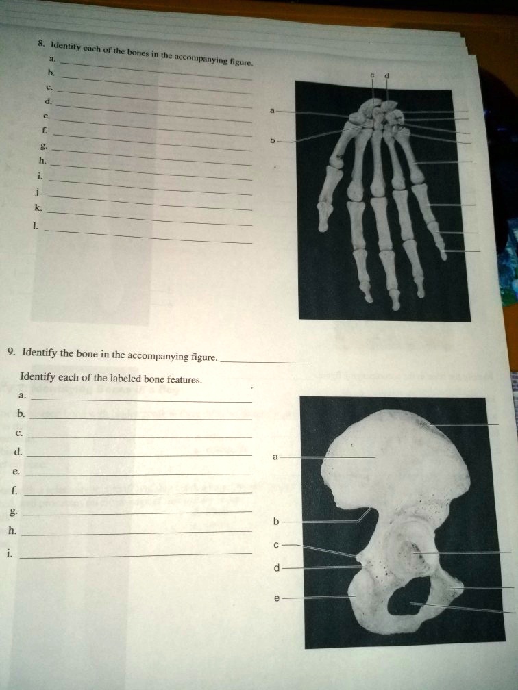 SOLVED: Identily cach of the bones thc accoinanvin Tigure Identify the bone in the accompanying ...