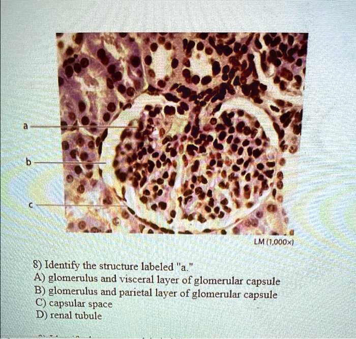 SOLVED: LM (1,000X) Identify the structure labeled: A) A glomerulus and ...