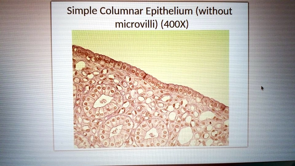 SOLVED: Simple Columnar Epithelium (without microvilli) (400X)