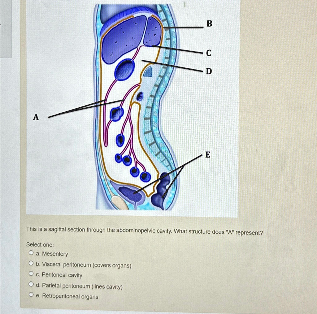 SOLVED: This is a sagittal section through the abdominopelvic cavity ...