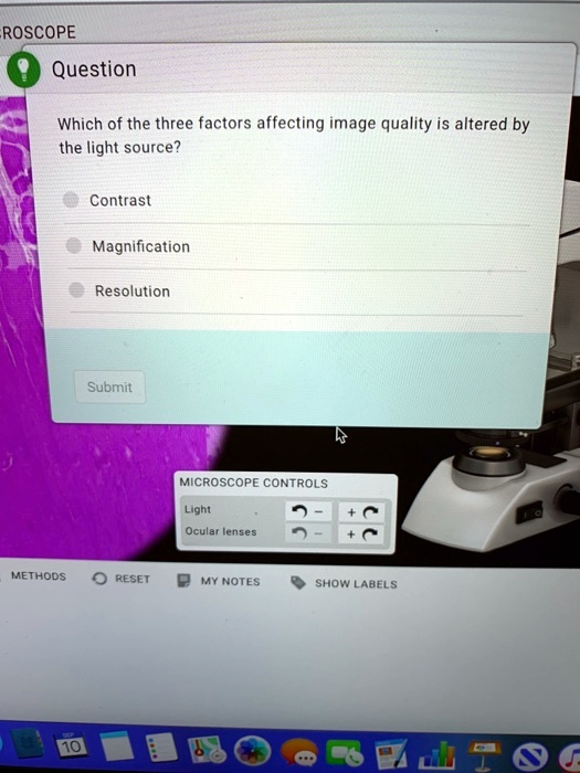 SOLVED: Which of the three factors affecting image quality is altered ...