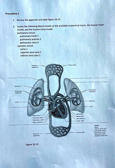 Procedure 2 1. Review the appendix and label figure 10-15. 2. Locate the following blood vessels ...