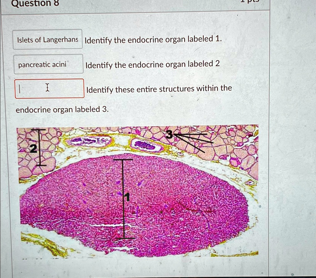 Question 8 Identify the endocrine organ labeled 1. Identify the ... Question 8 Identify the endocrine organ labeled 1. Identify the ...