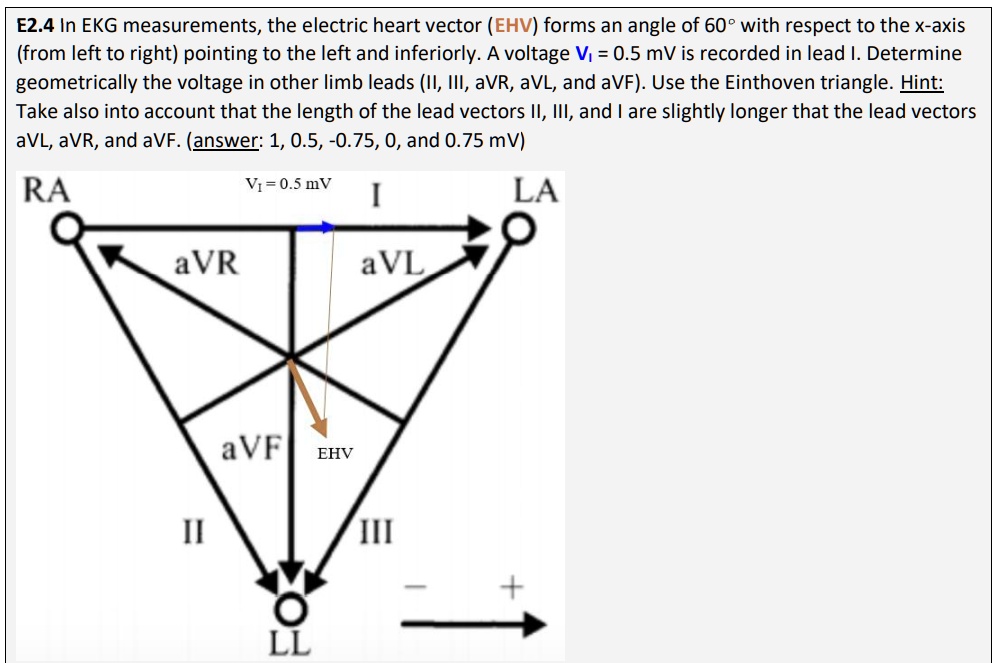 SOLVED: E2.4 In EKG measurements, the electric heart vector (EHV) forms ...