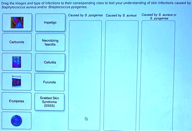 SOLVED: Drag the images and types of infections to their corresponding ...