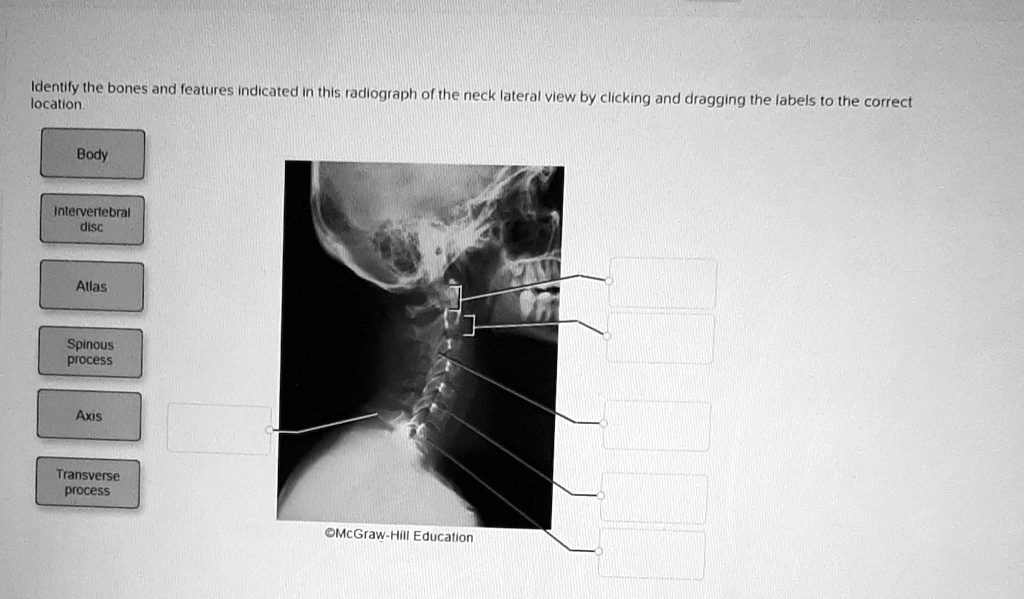 [GET ANSWER] Identify the bones and features indicated in this radiograph of the neck lateral ...