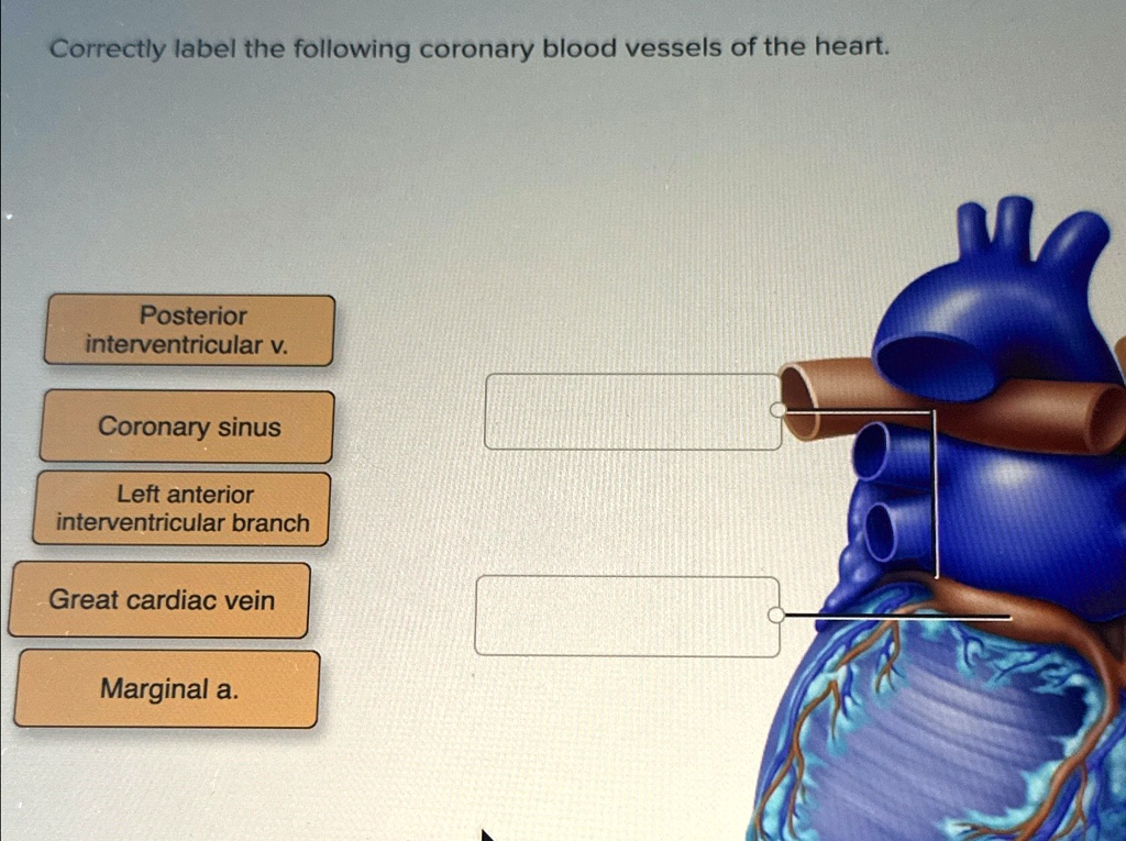 Correctly label the following coronary blood vessels of the heart. Left ...