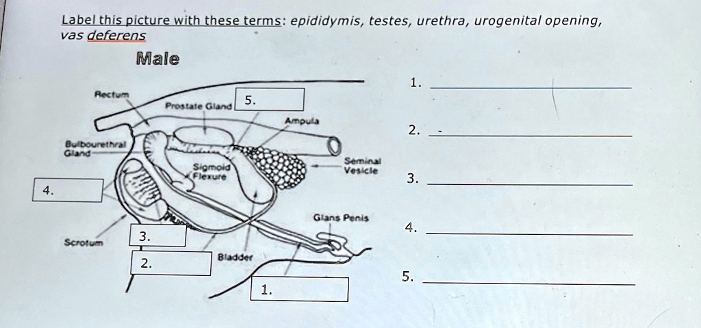 Label this picture with these terms: epididymis, testes, urethra ...