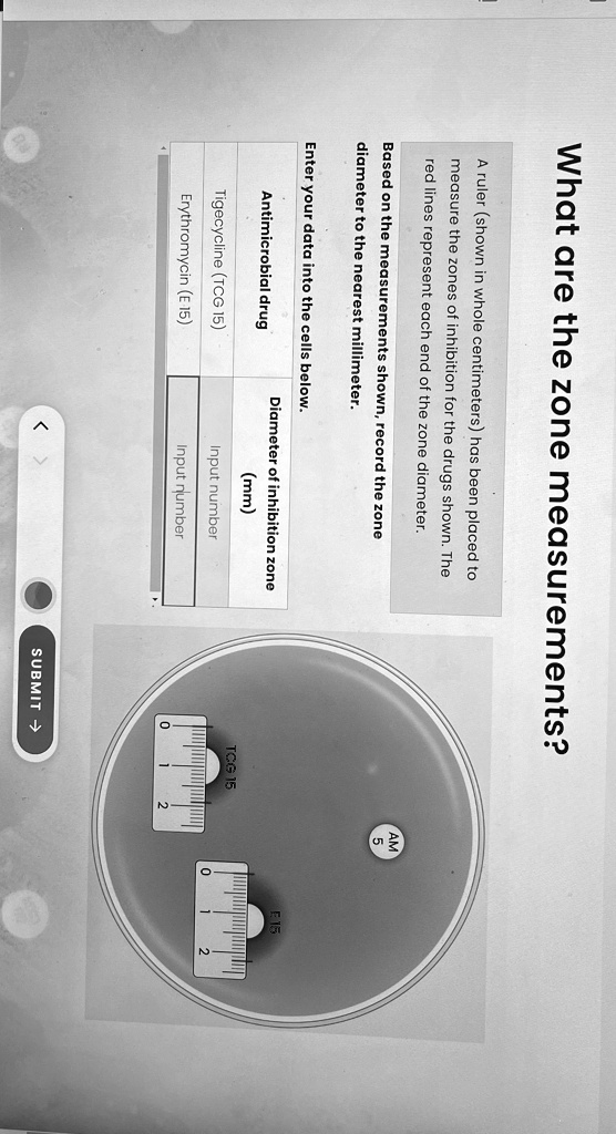 What are the zone measurements? A ruler (shown in whole centimeters ...