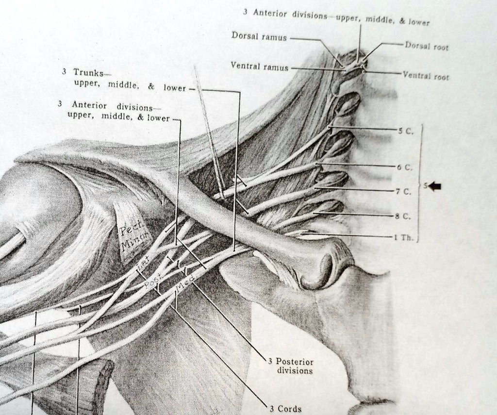 SOLVED: Label the structures of the brachial plexus on the figure below ...