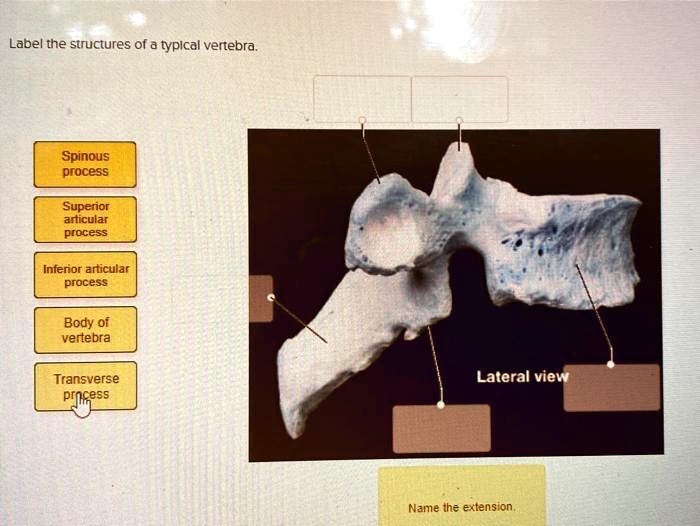 Label the structures of a typical vertebra: - Spinous process ...