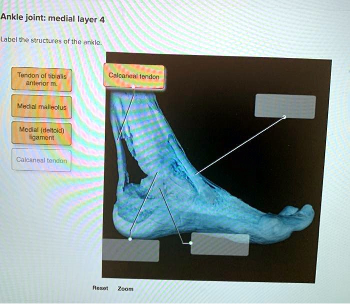 Ankle joint: medial layer 4 Label the structures of the...