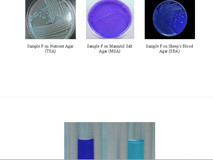 sarple on nutrent agar tsa sarnple on mannitol salt agar msa sample on ...